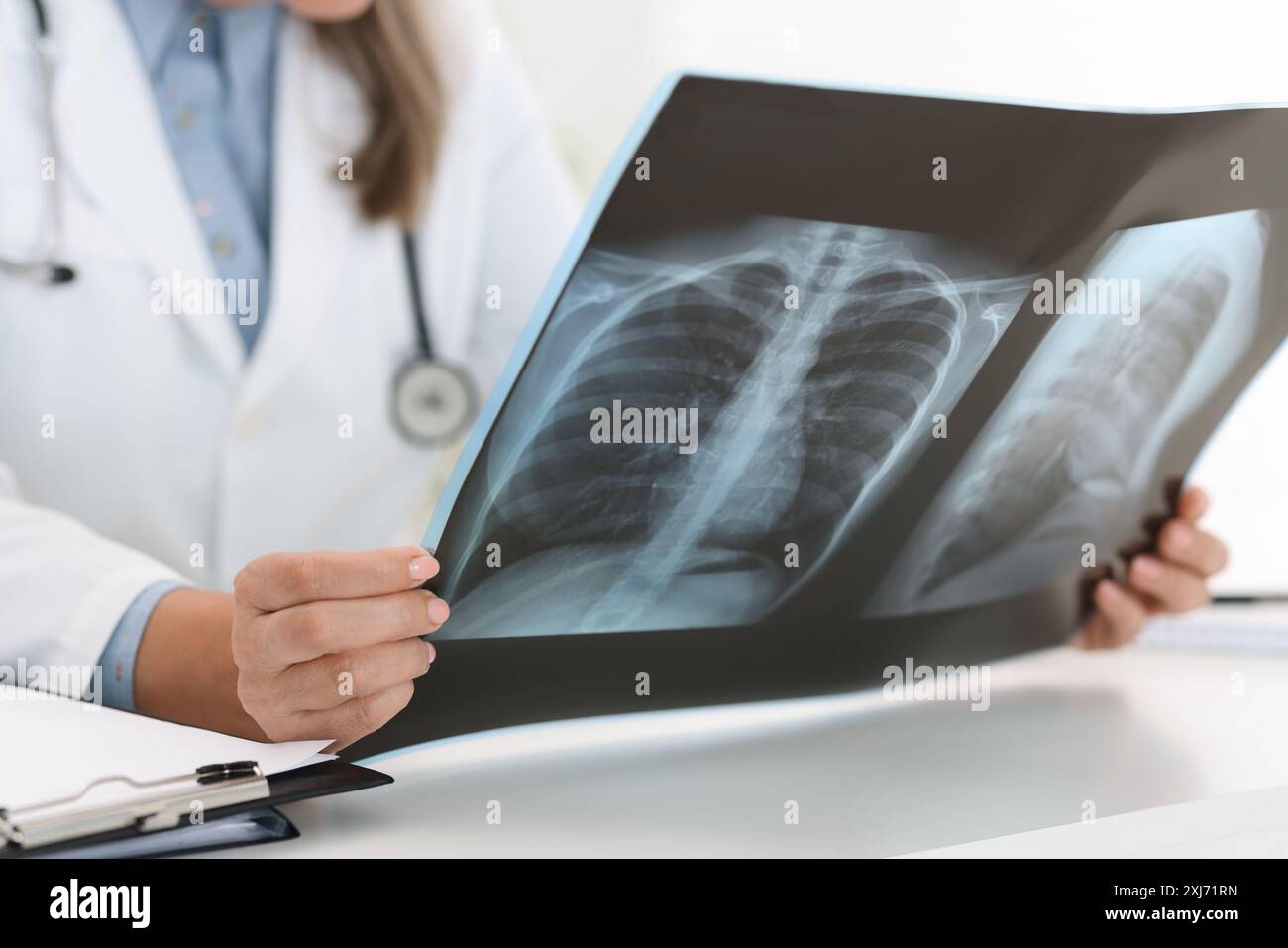 Lung disease. Doctor examining chest x-ray at table in clinic, closeup ...