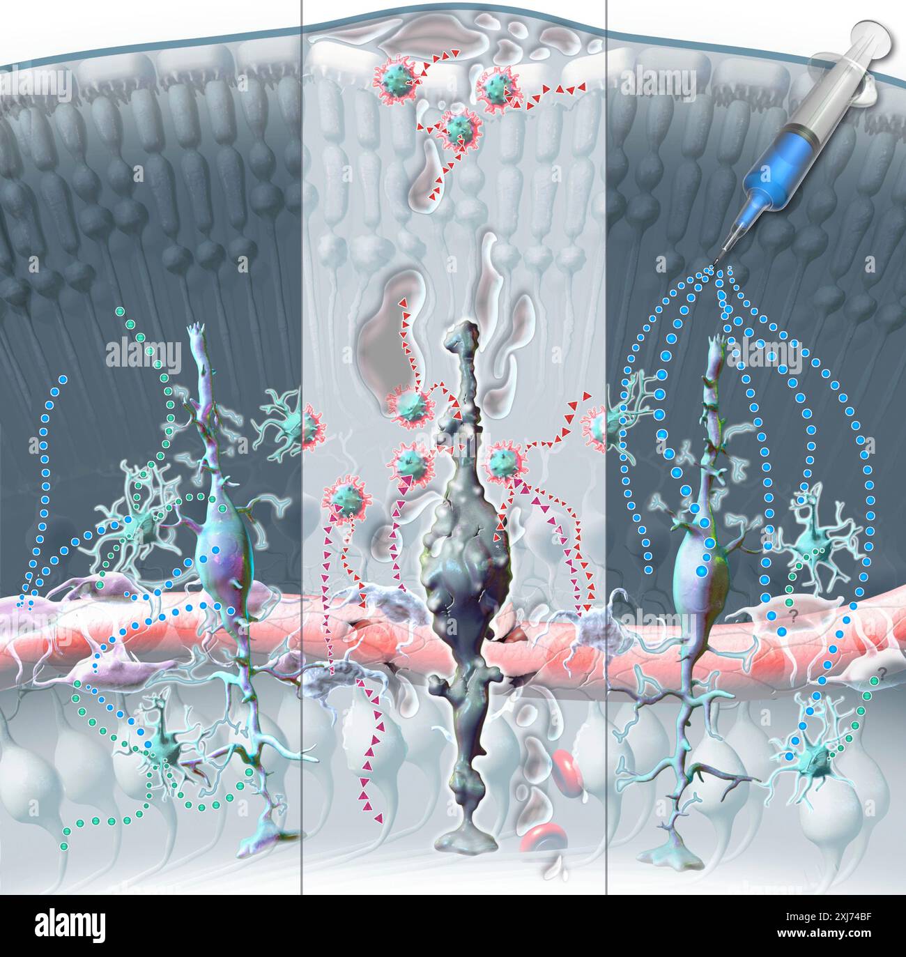 Illustration of treatments for neuron (nerve cell, three across lower ...