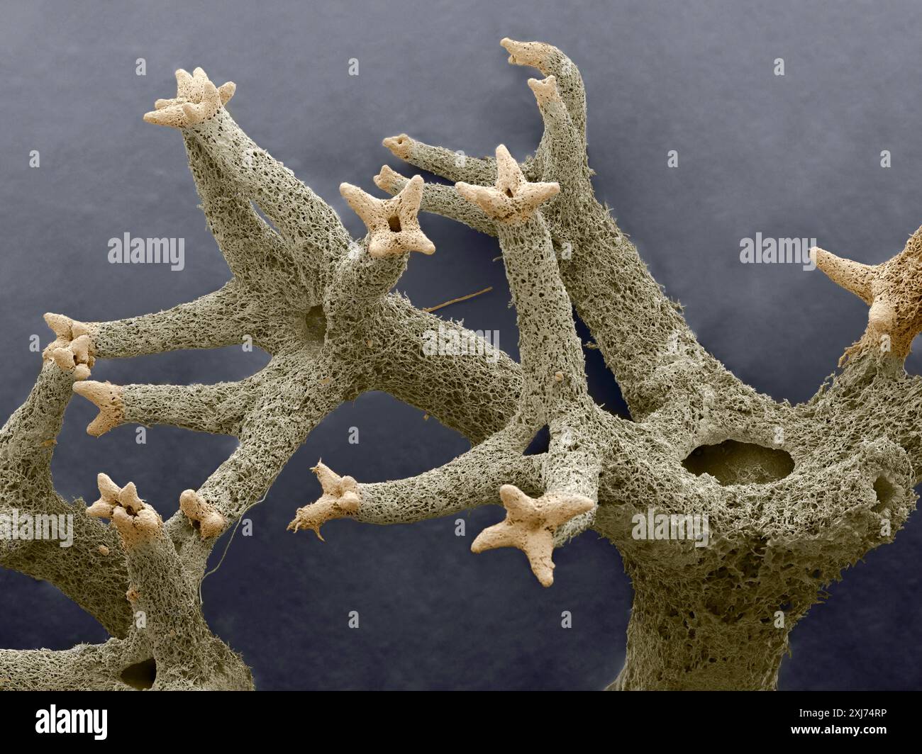 Coloured scanning electron micrograph (SEM) of reindeer lichen ...