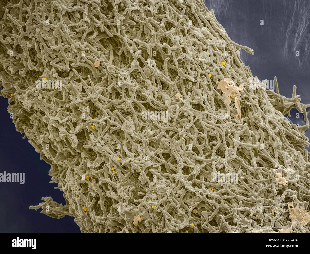 Coloured scanning electron micrograph (SEM) of reindeer lichen ...