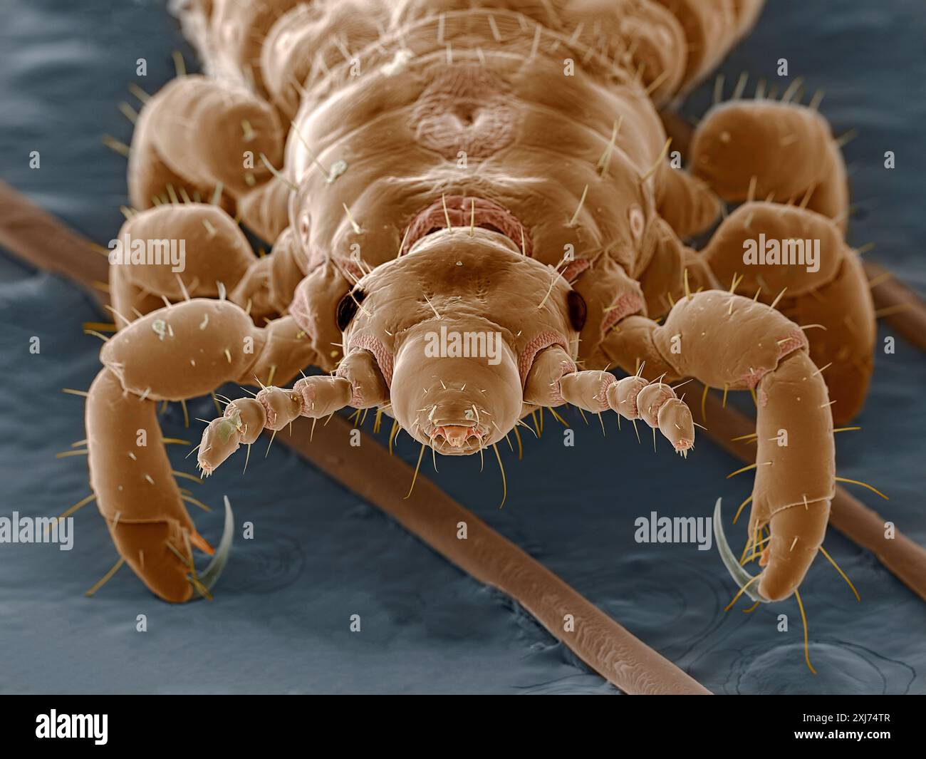Coloured scanning electron micrograph of a head louse (Pediculus ...