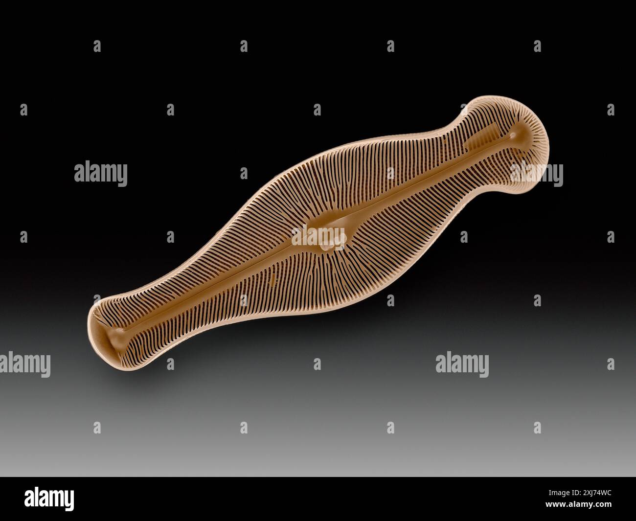 Coloured scanning electron micrograph (SEM) of a Didymosphenia geminata ...