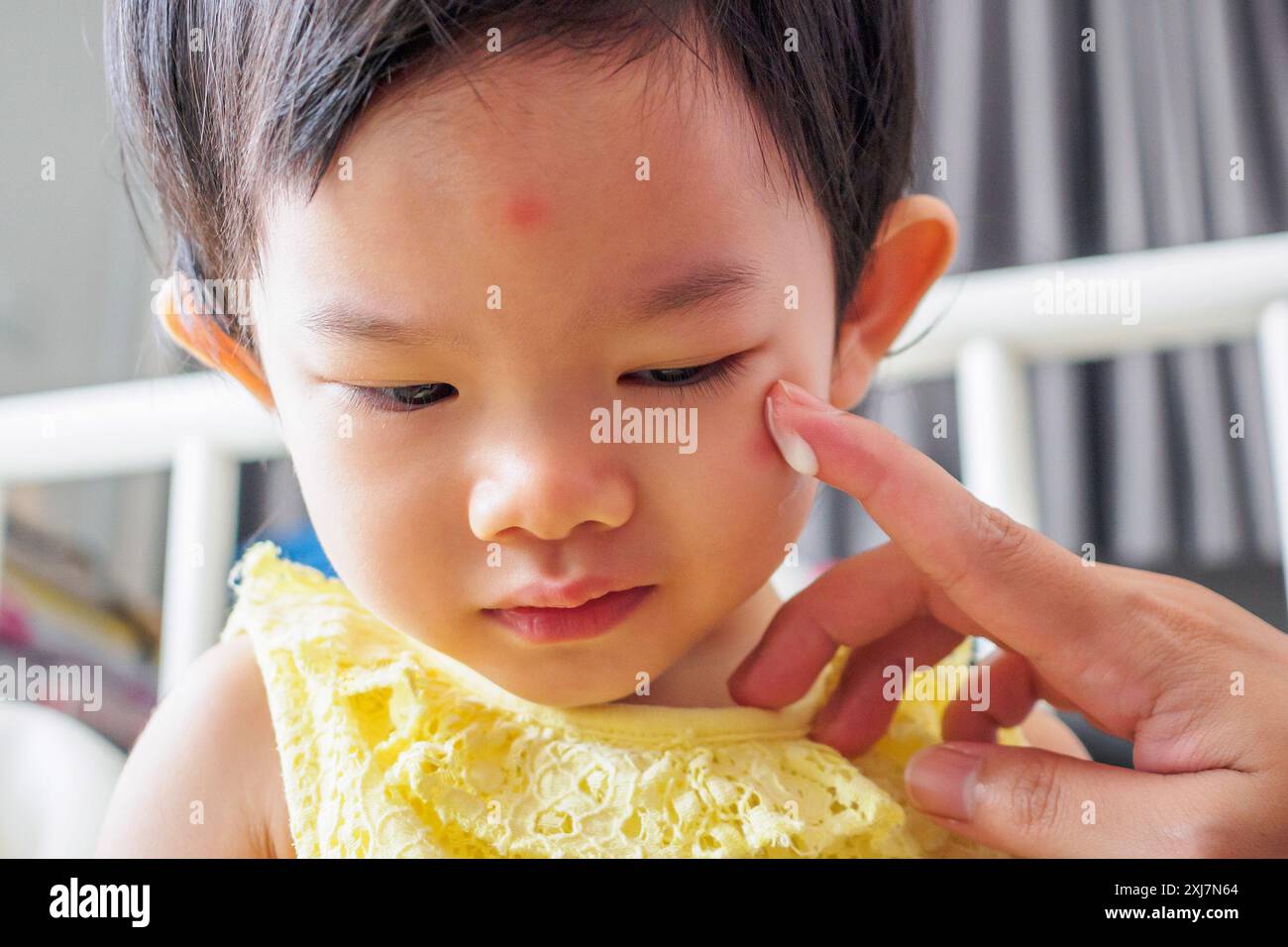 mother applying antiallergic medicine cream at cute asian girl face ...