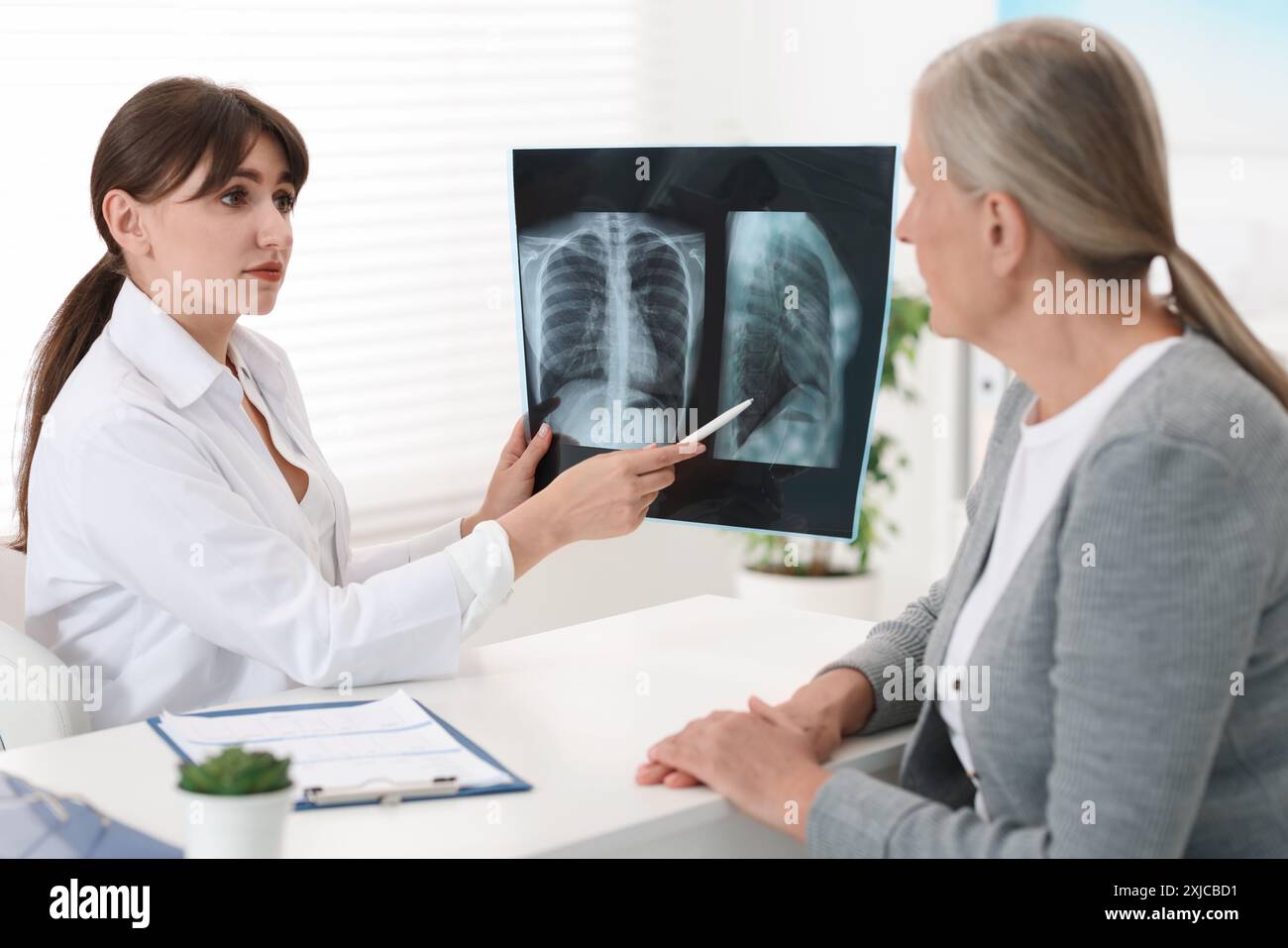 Lung disease. Doctor showing chest x-ray to her patient at table in ...