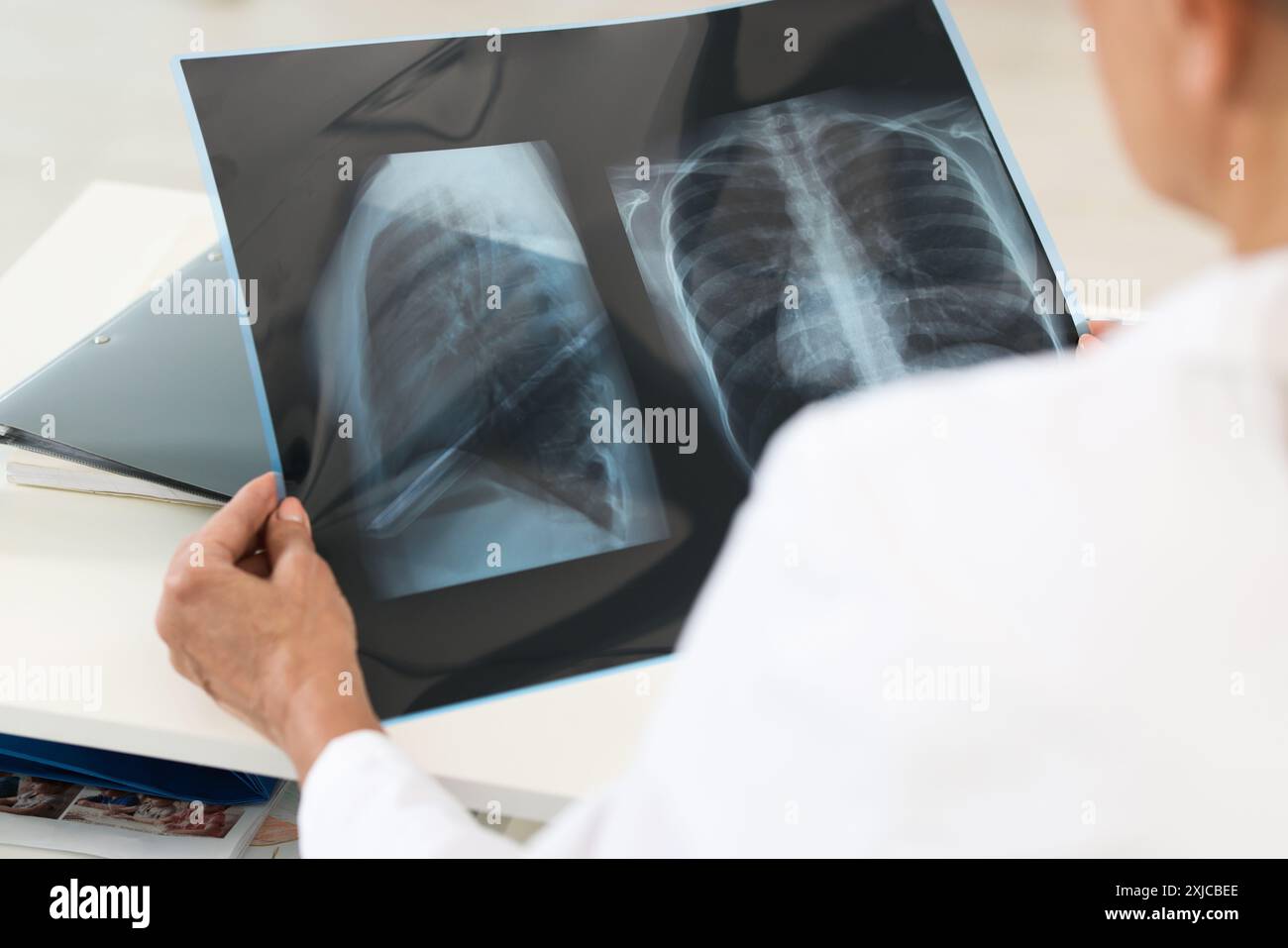 Lung disease. Doctor examining chest x-ray in clinic, closeup Stock ...