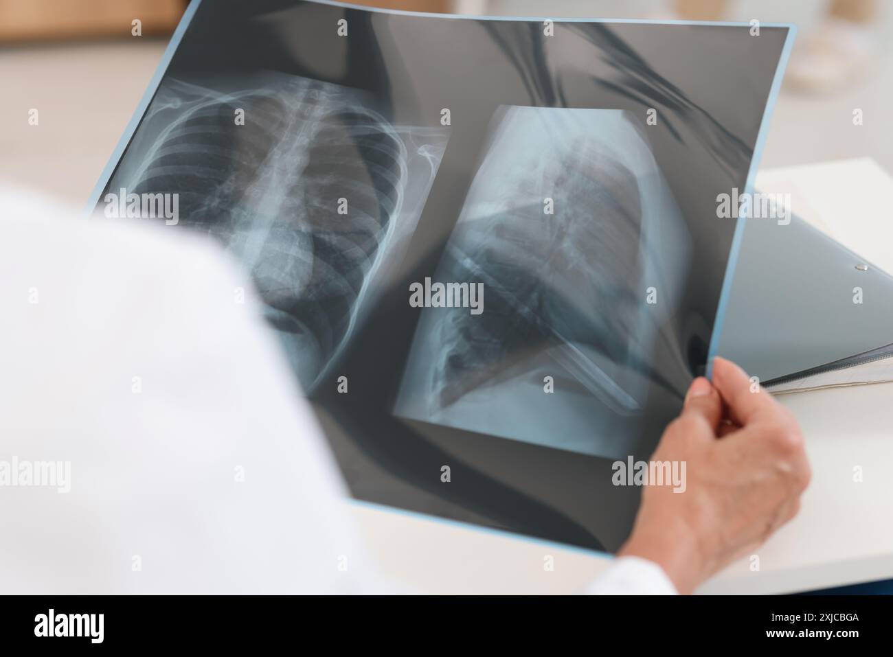 Lung disease. Doctor examining chest x-ray at table in clinic, closeup ...