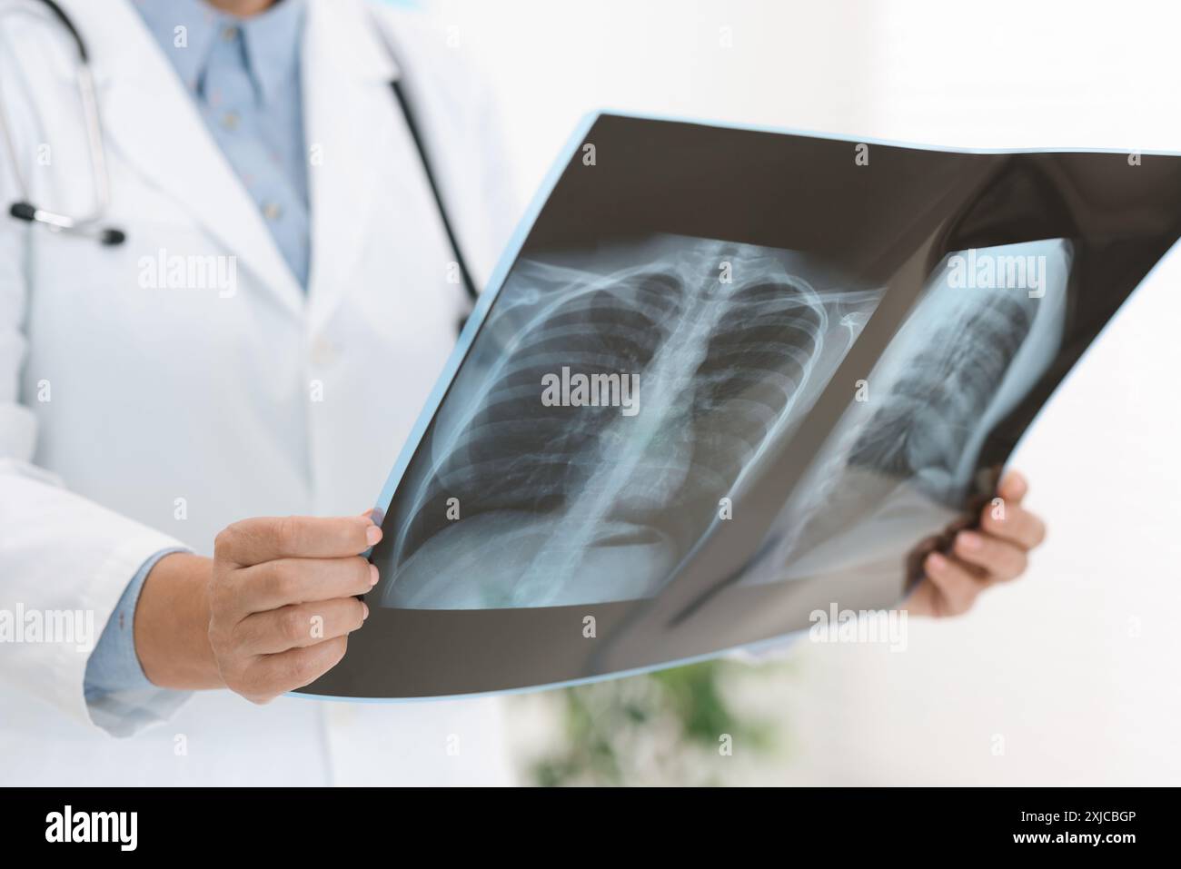 Lung disease. Doctor examining chest x-ray in clinic, closeup Stock ...