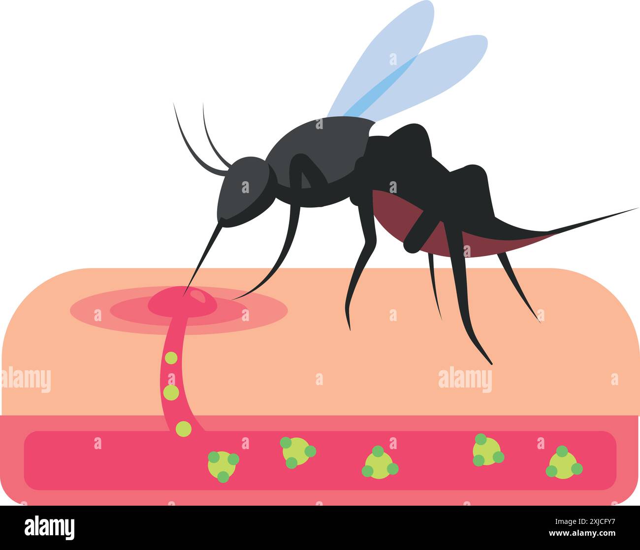 inflamed dengue mosquito bite Stock Vector Image & Art - Alamy