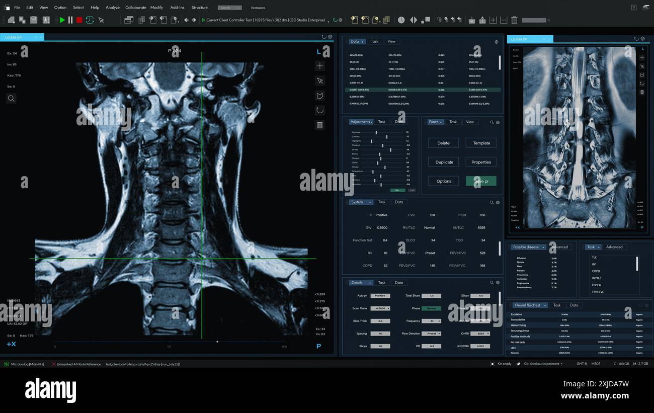 3D Render: Magnetic Resonance Imaging Spinal Cord Scan Mock-up with ...