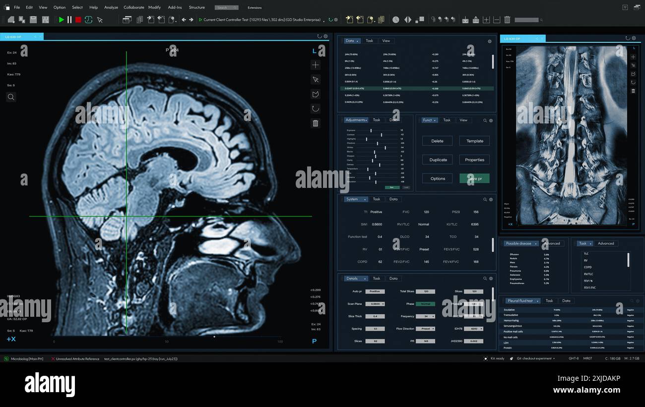 Imaging analysis software hi-res stock photography and images - Alamy