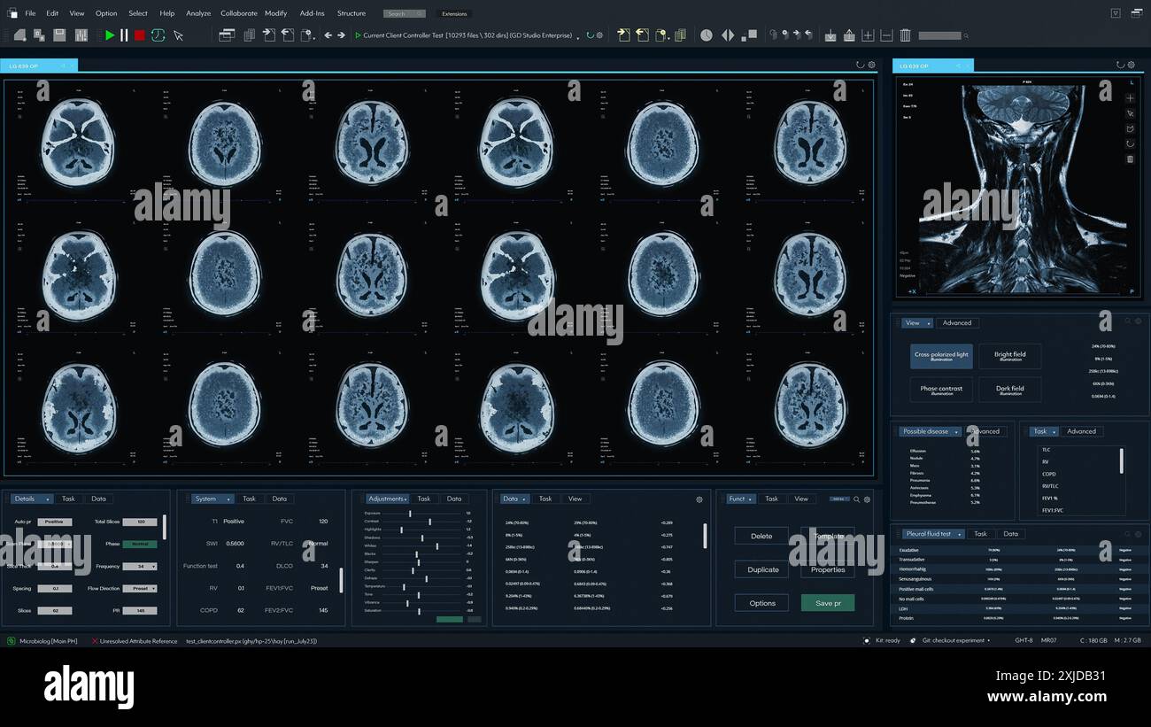 Imaging analysis software hi-res stock photography and images - Alamy