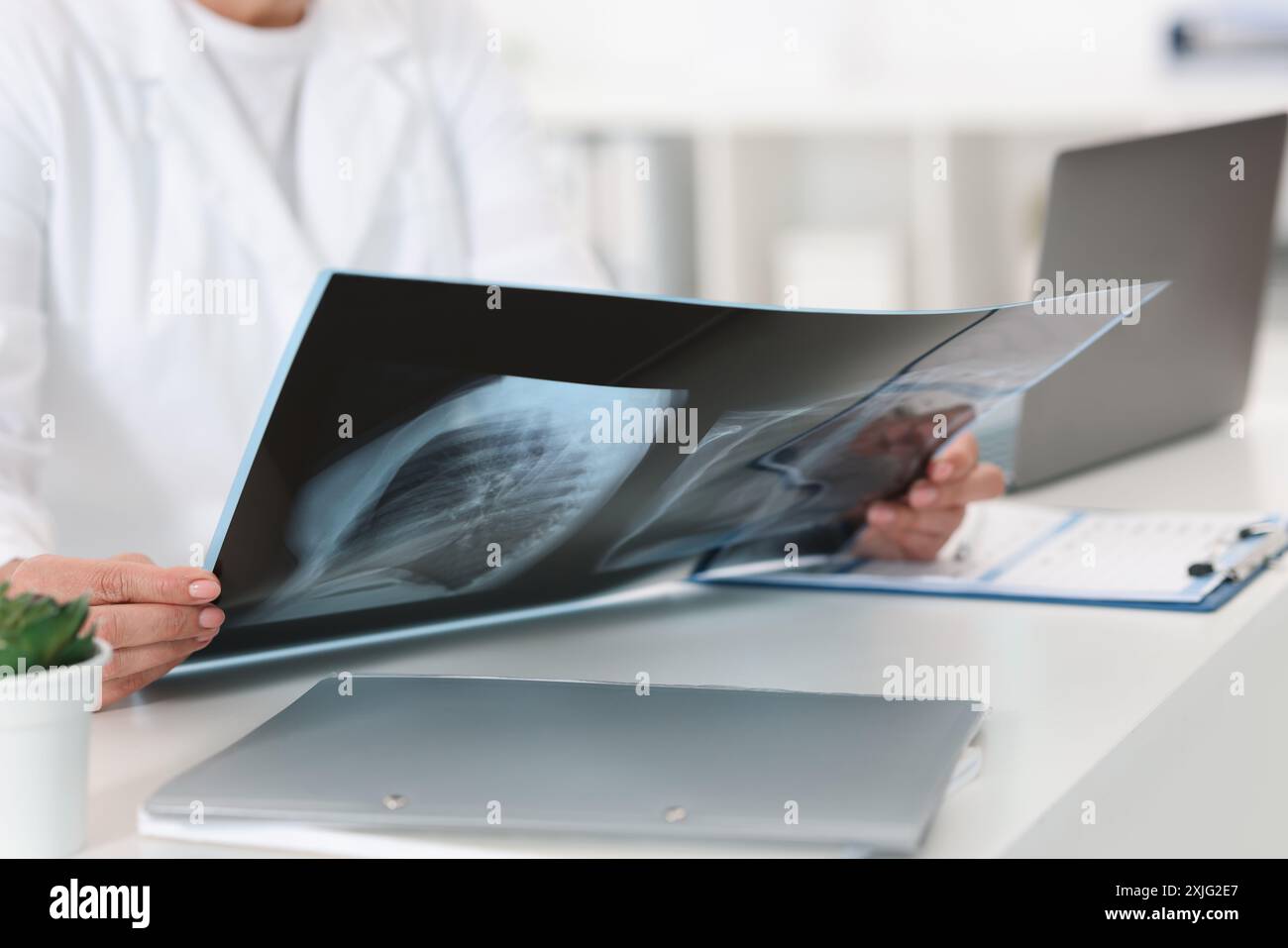 Lung disease. Doctor examining chest x-ray at table in clinic, closeup ...