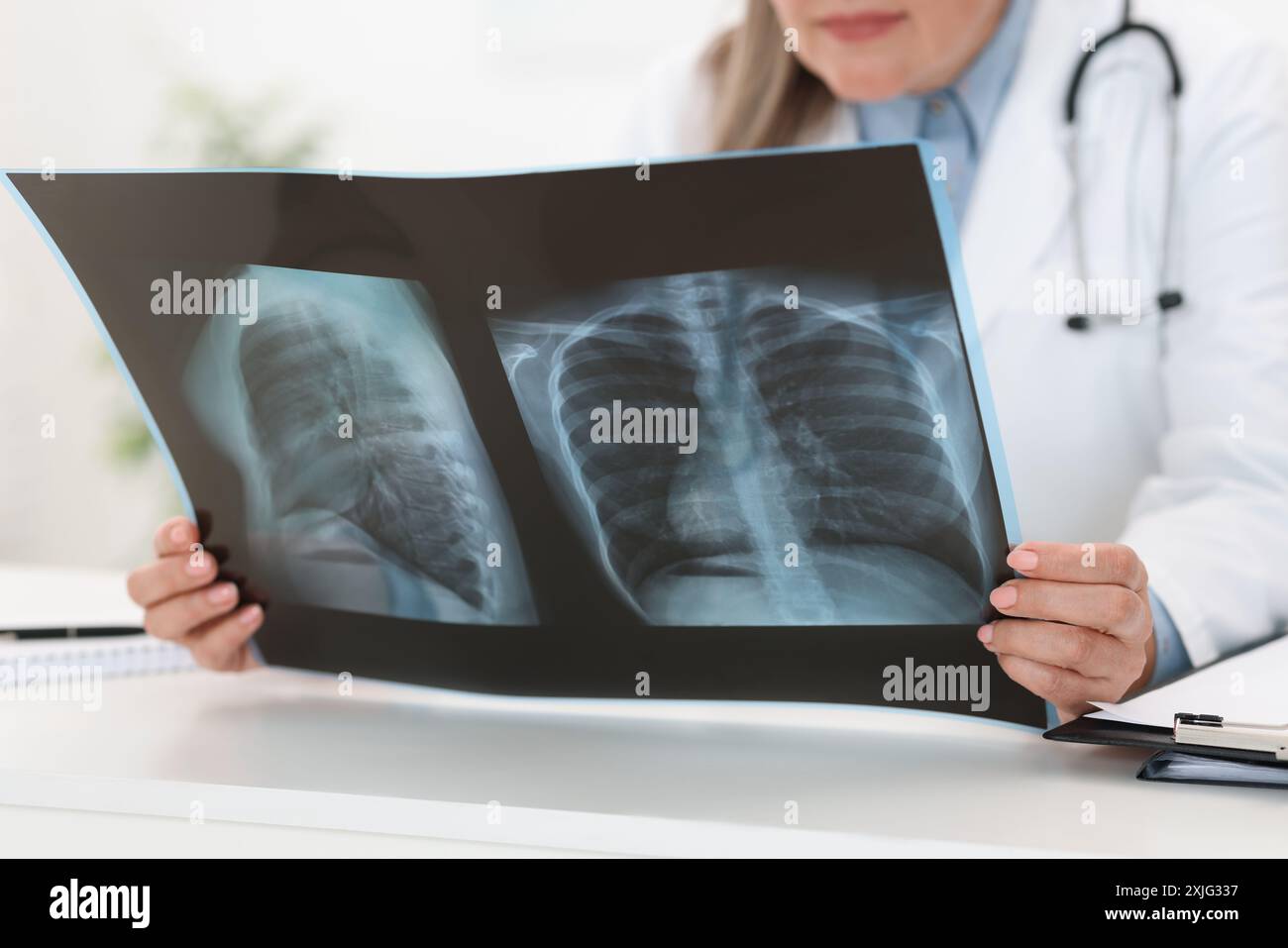 Lung disease. Doctor examining chest x-ray at table in clinic, closeup ...