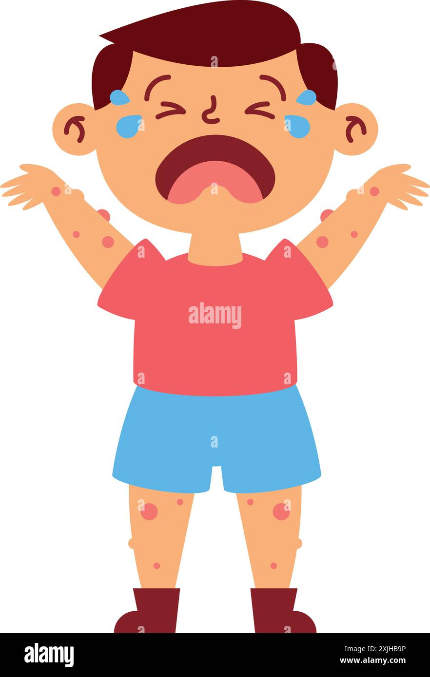 boy crying becaues many of mosquito biting him body Stock Vector Image ...