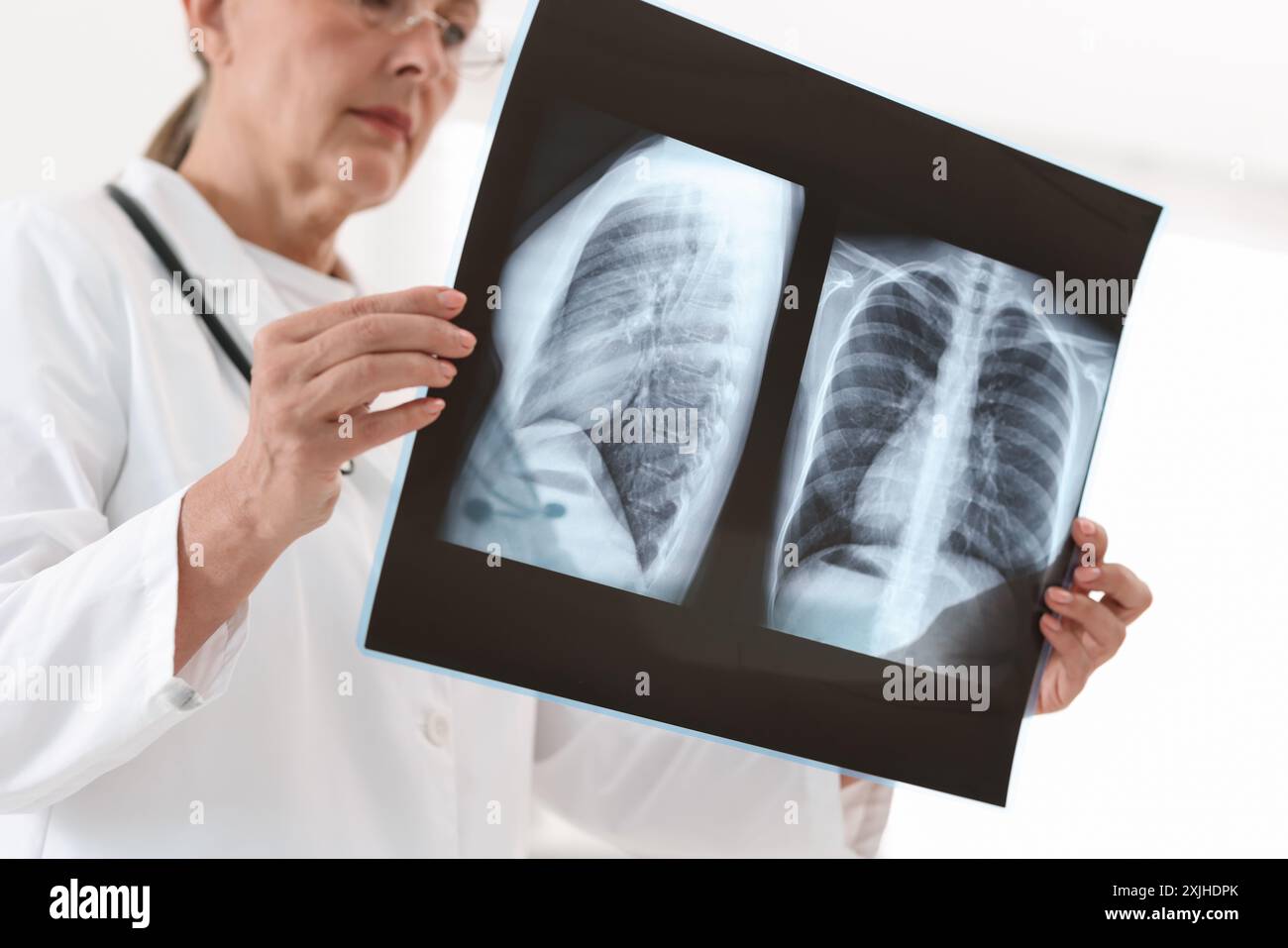 Lung disease. Doctor examining chest x-ray in clinic, low angle view ...