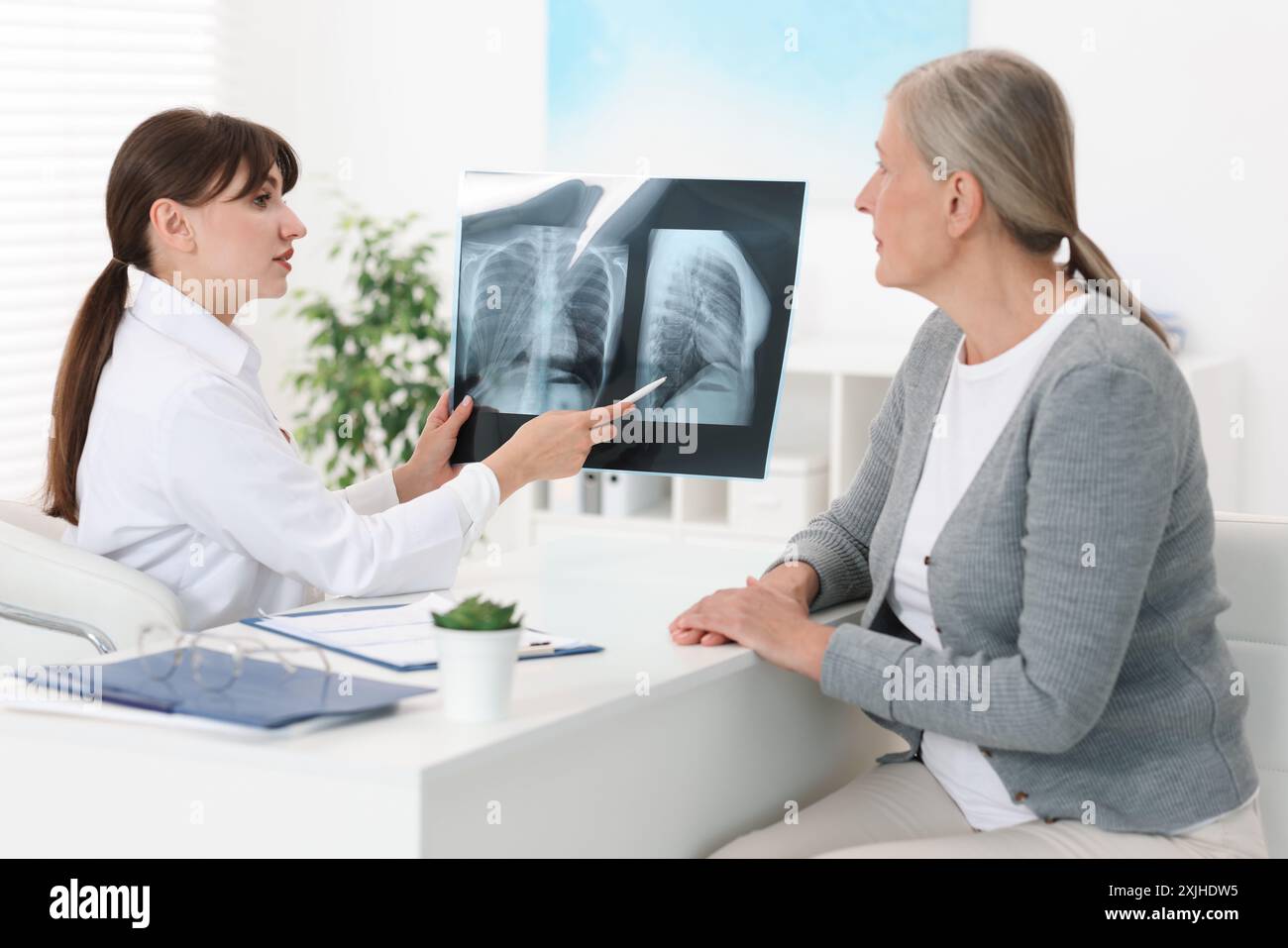 Lung disease. Doctor showing chest x-ray to her patient at table in ...
