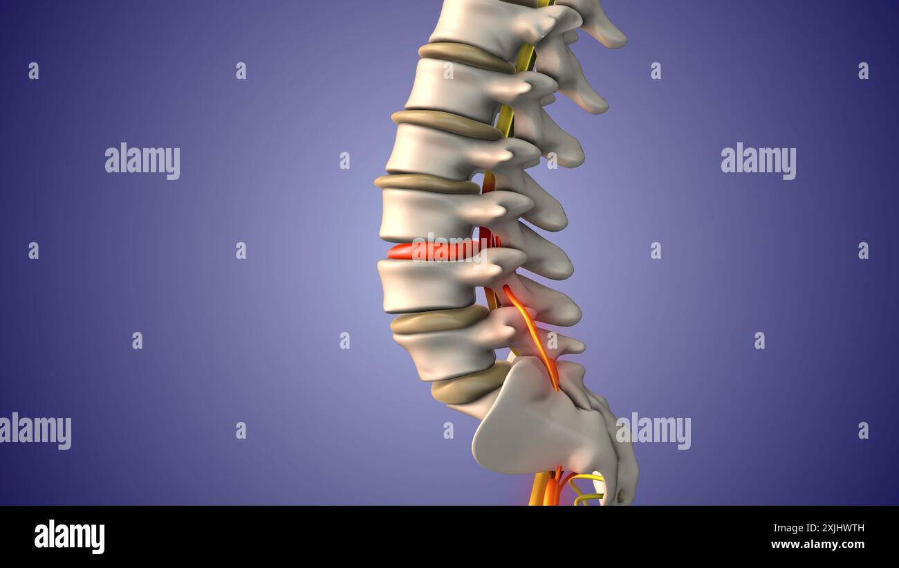 Sciatic nerve pain due to herniated disc Stock Photo - Alamy