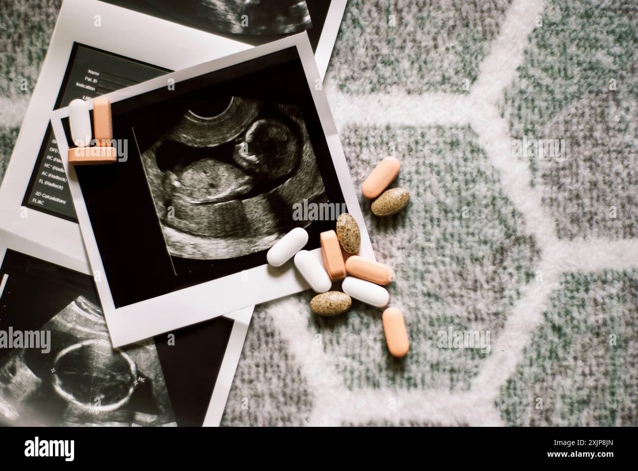 Artificial birth control hi-res stock photography and images - Alamy