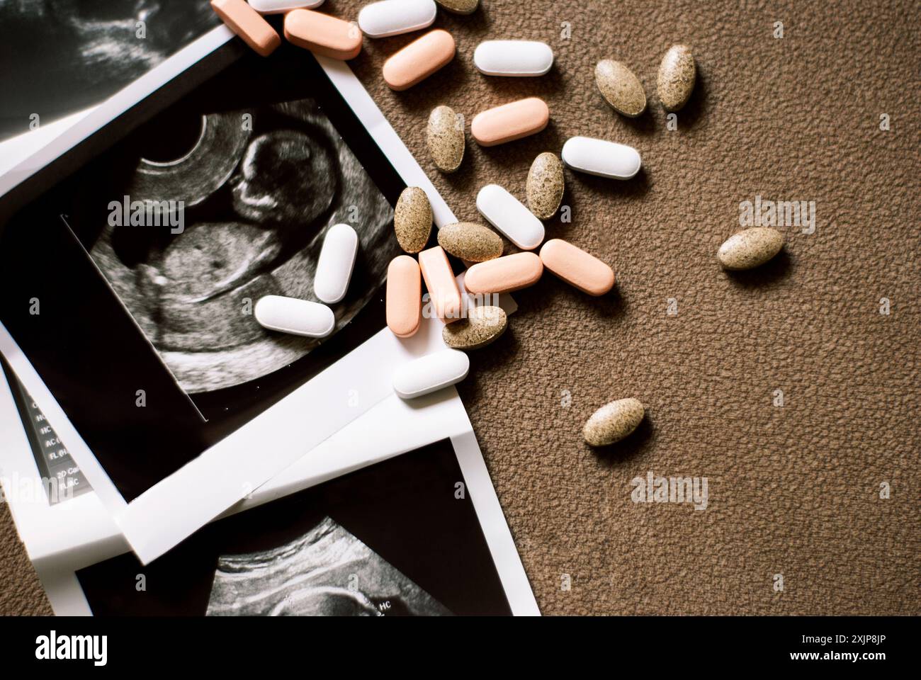 Photo of the fetus on an ultrasound scan and few pills on brown ...