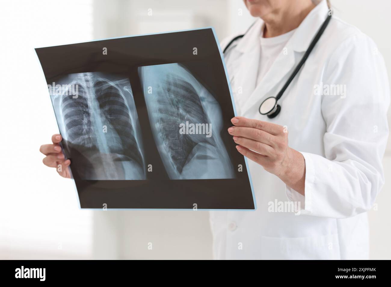 Lung disease. Doctor examining chest x-ray in clinic, closeup Stock ...