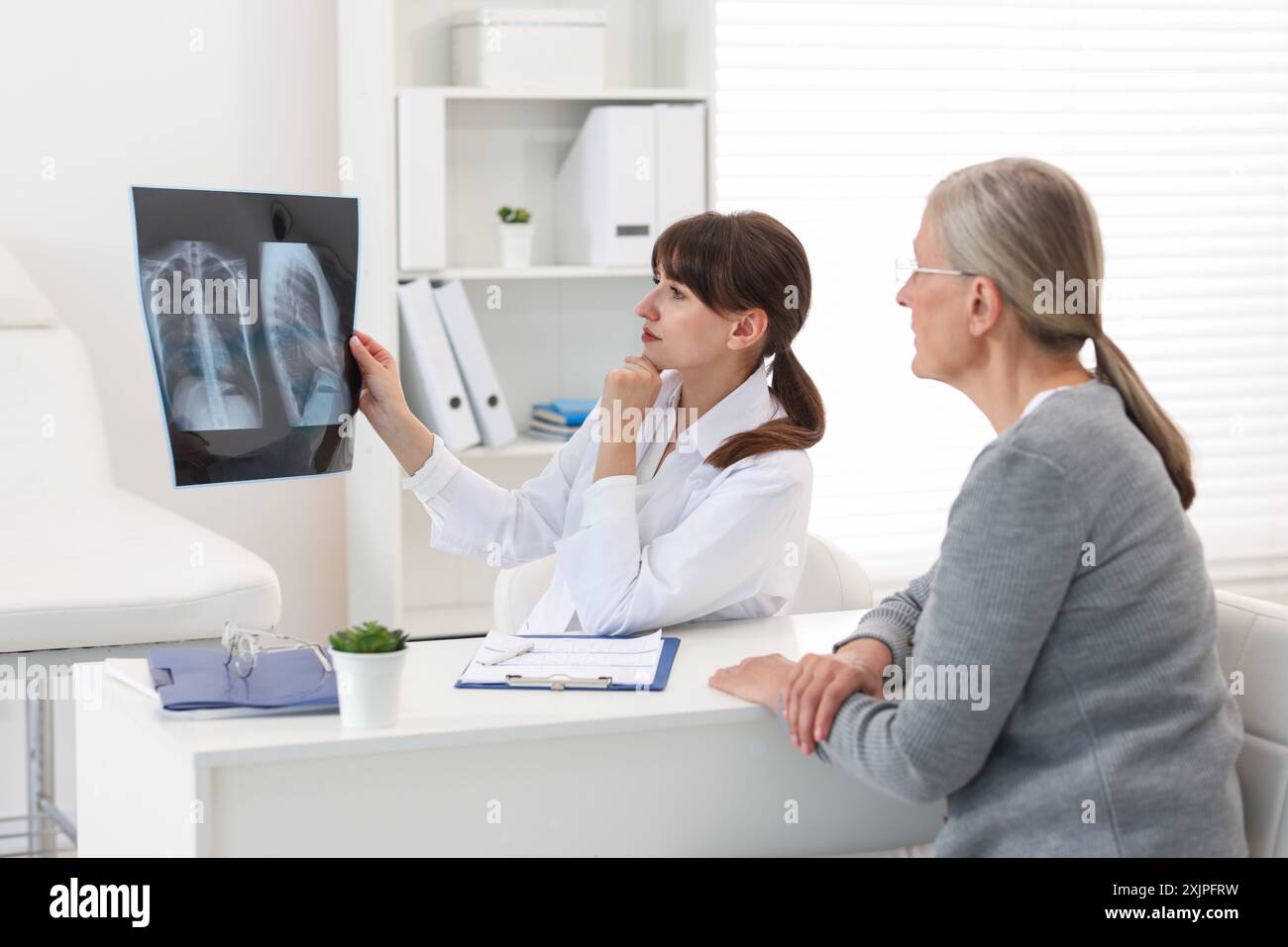 Lung disease. Doctor showing chest x-ray to her patient at table in ...
