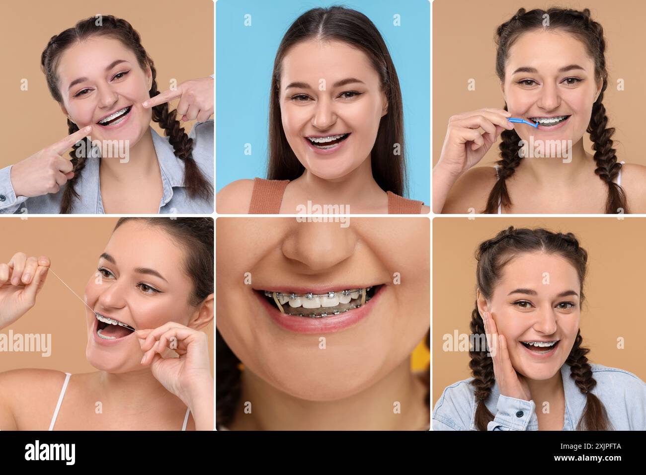Girl wearing braces on different colors backgrounds, collage of photos ...