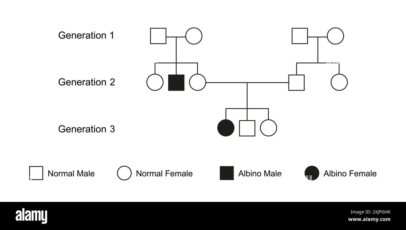 Albinism karyotype, illustration Stock Photo - Alamy