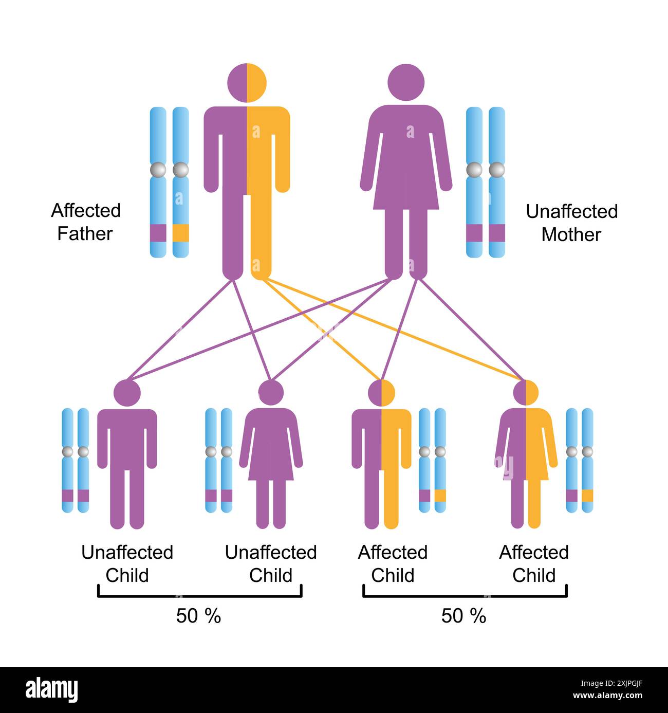 Autosomal dominant inheritance, illustration Stock Photo - Alamy