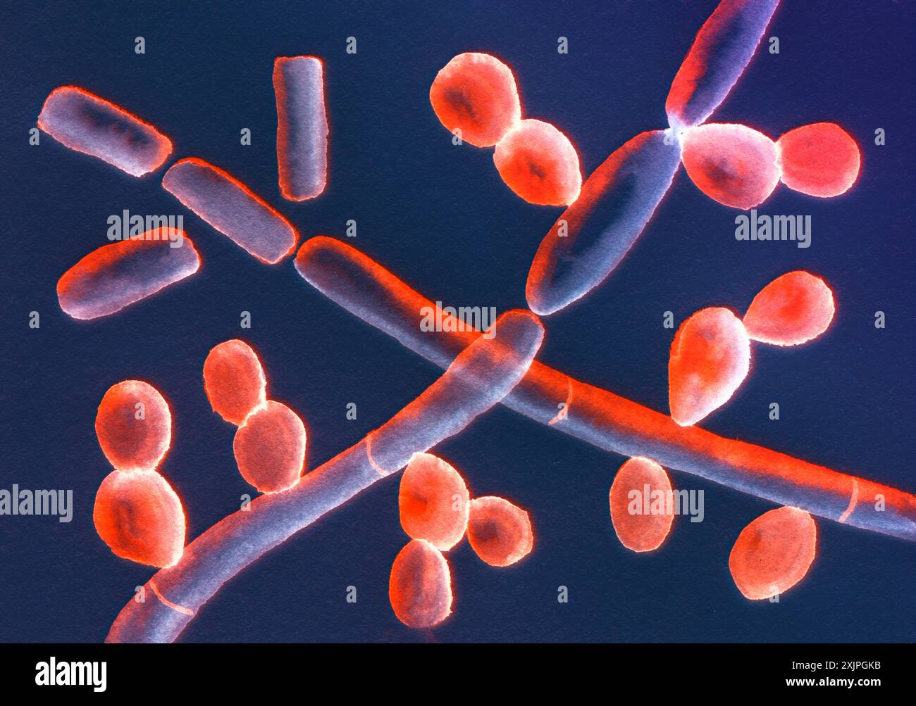 Illustration showing the microscopic fungi Trichosporon, showing ...