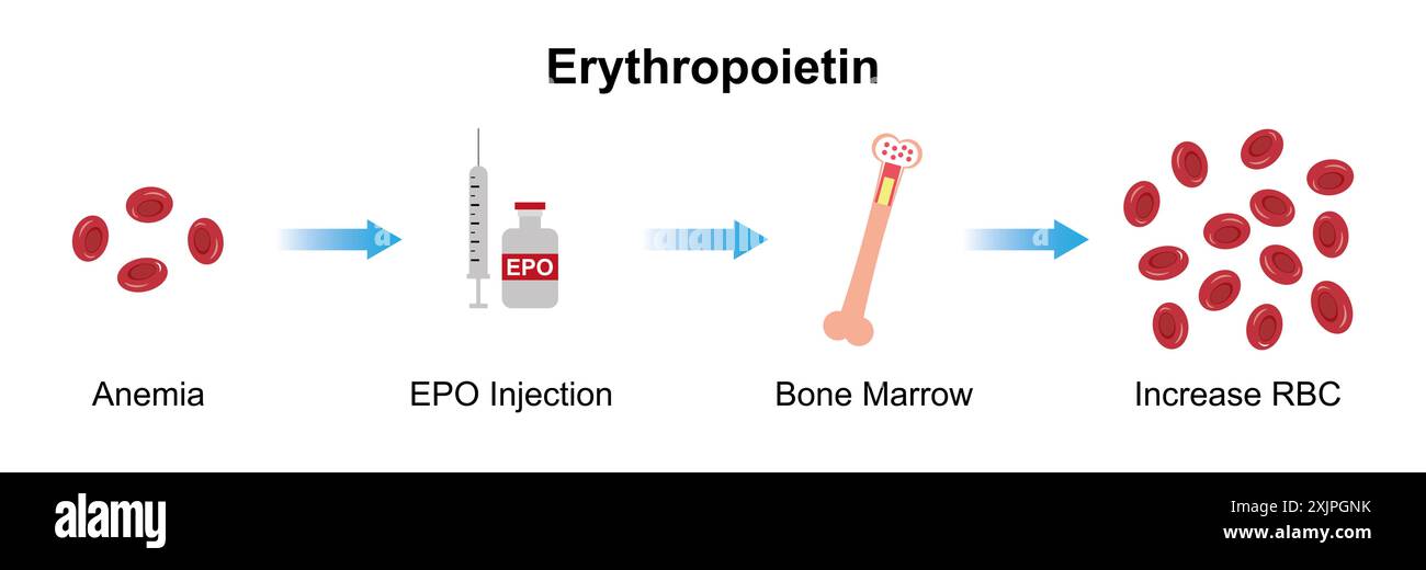Erythropoietin levels hi-res stock photography and images - Alamy