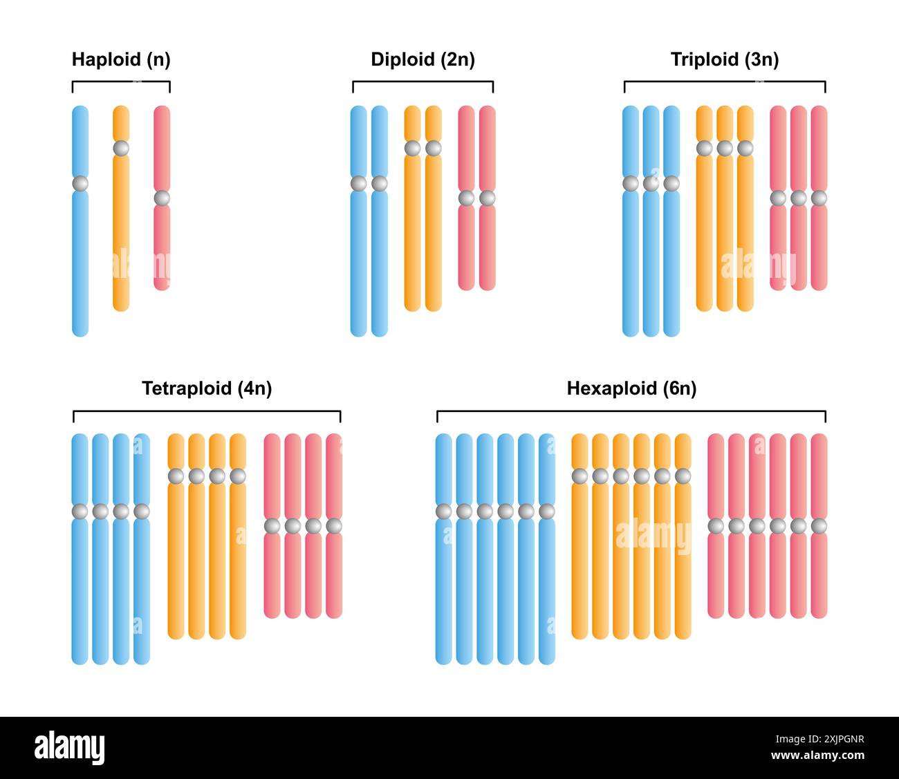 Polyploidy Baby