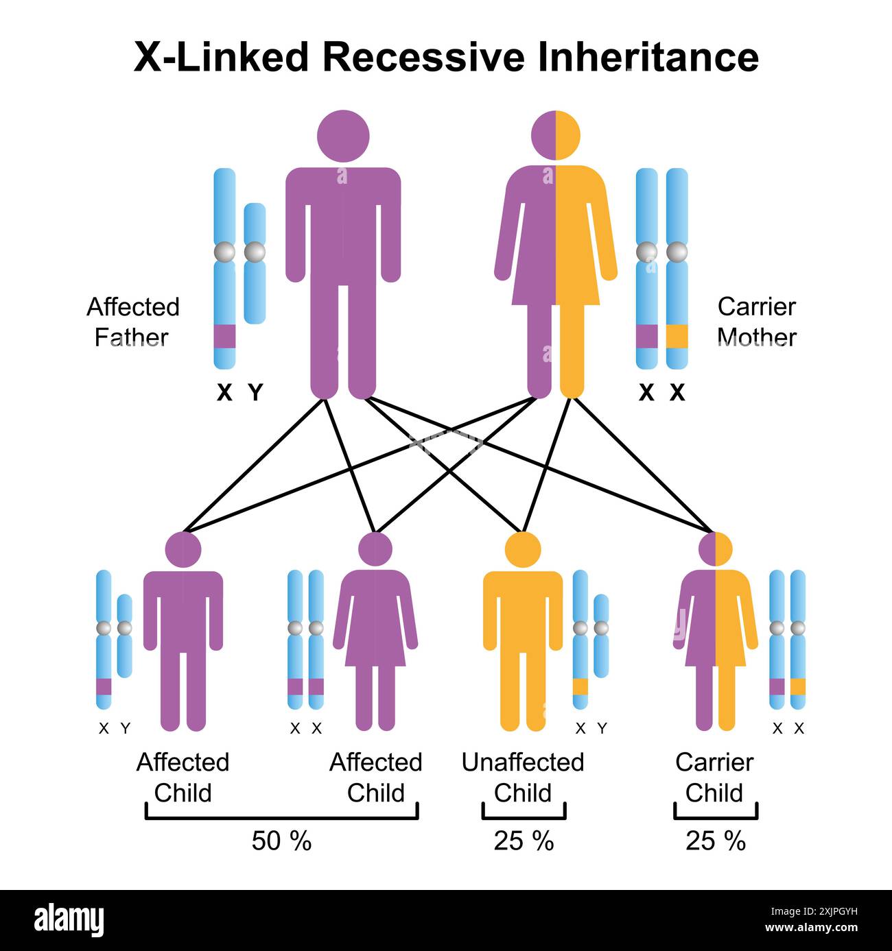 X-linked recessive inheritance, illustration Stock Photo - Alamy