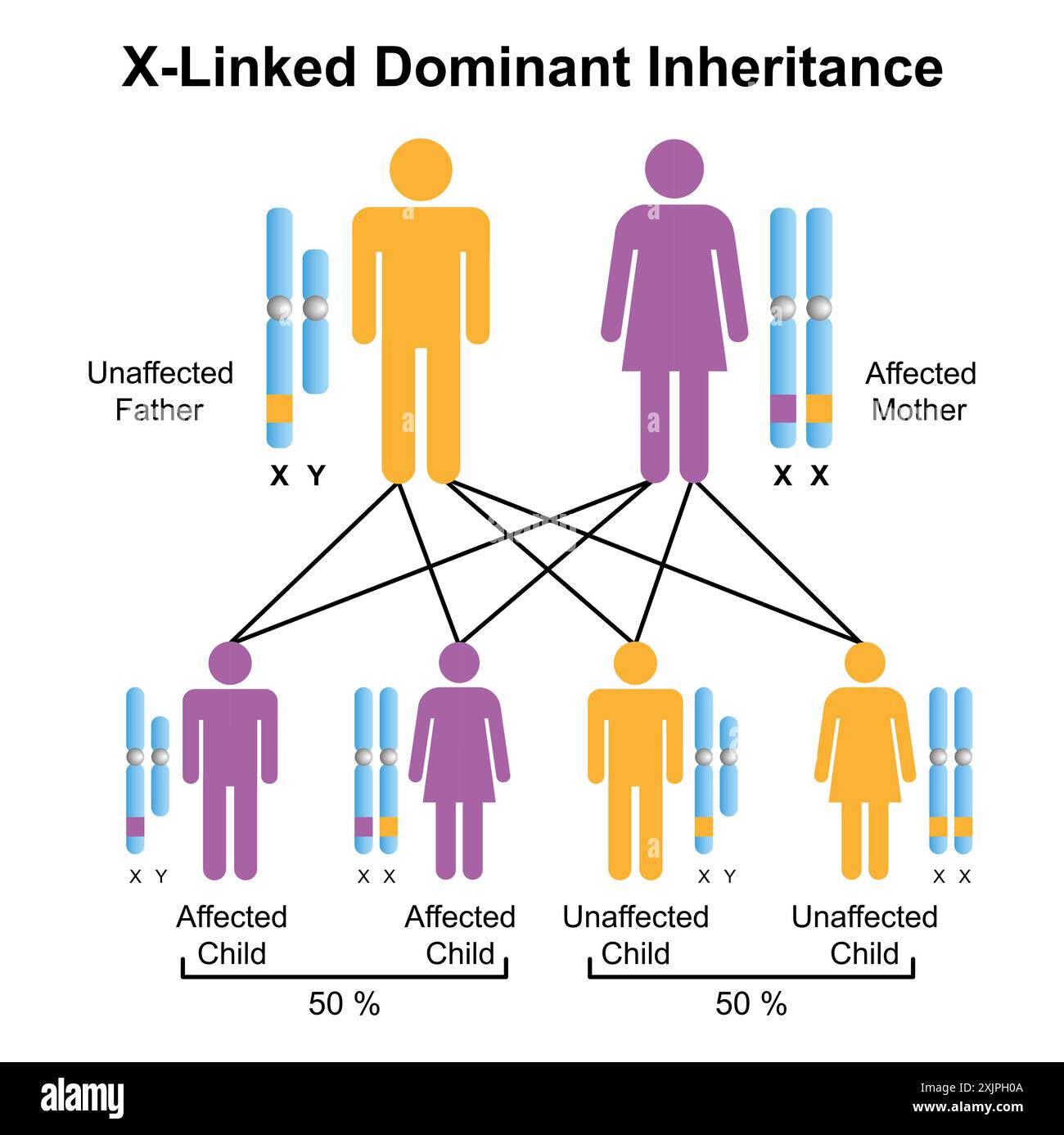 X-linked dominant inheritance, illustration Stock Photo - Alamy X-linked dominant inheritance, illustration Stock Photo - Alamy