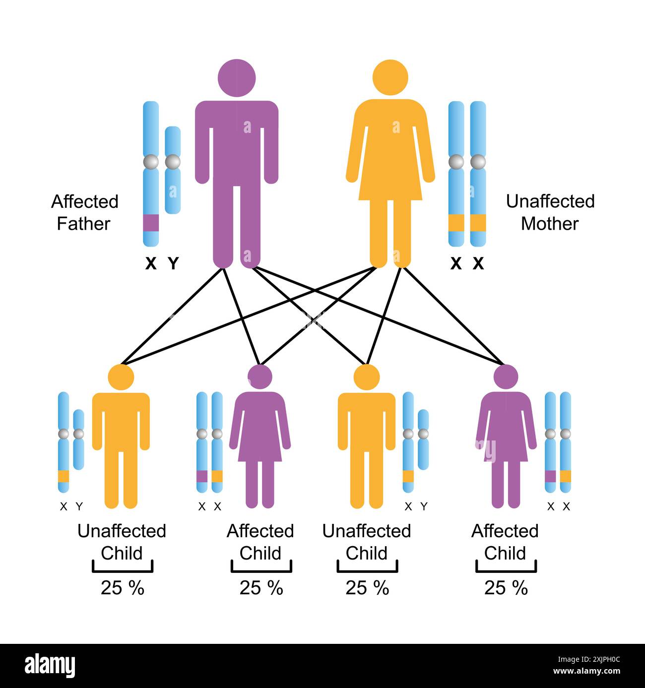 X-linked dominant inheritance, illustration Stock Photo - Alamy
