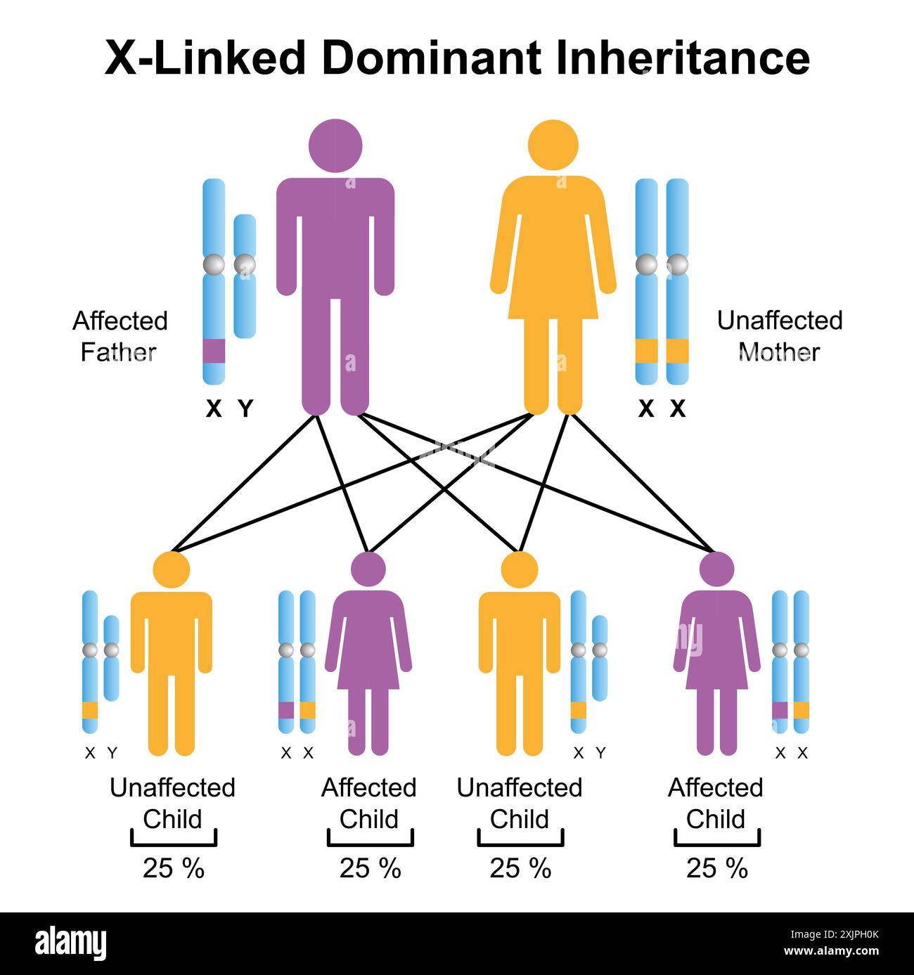 X-linked dominant inheritance, illustration Stock Photo - Alamy