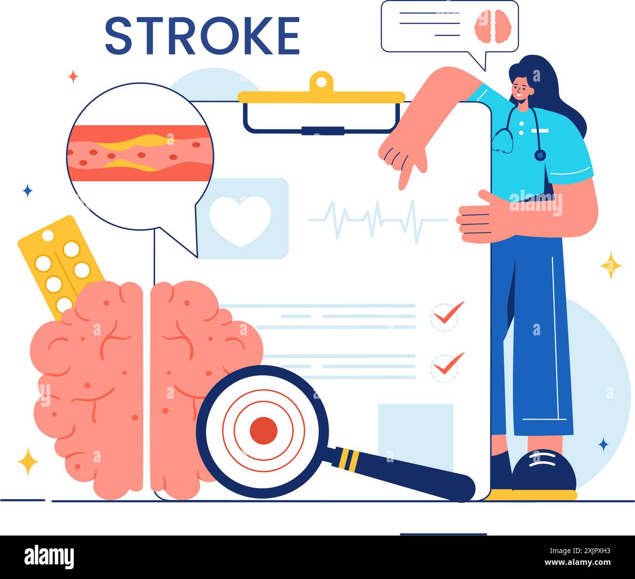 A Vector Illustration of Human Brain Stroke Highlighting Medical ...