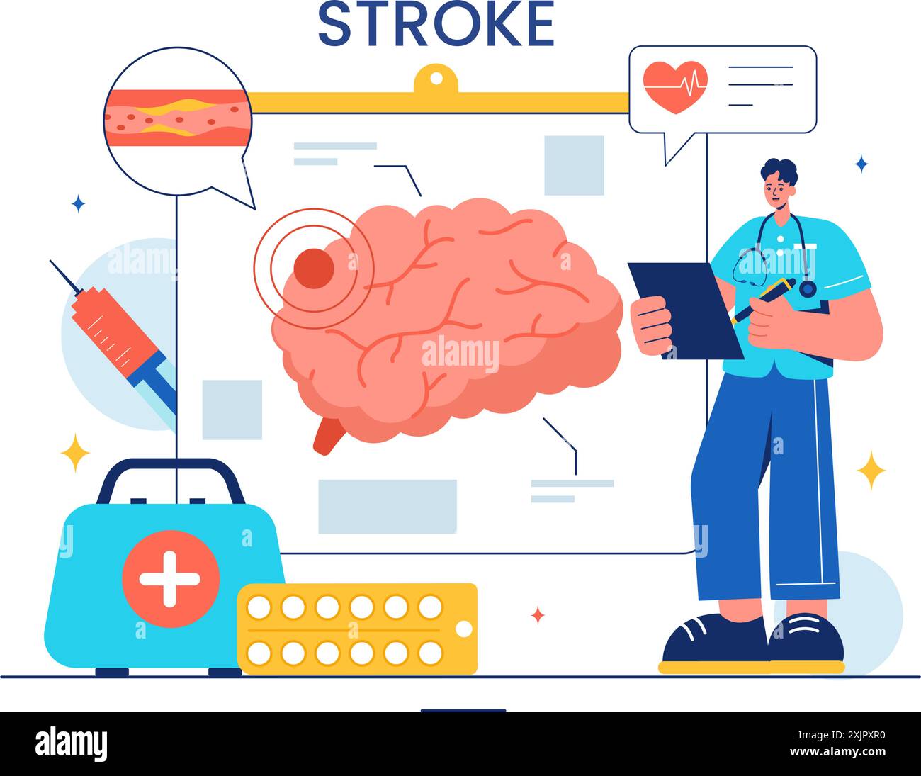 A Vector Illustration of Human Brain Stroke Highlighting Medical ...