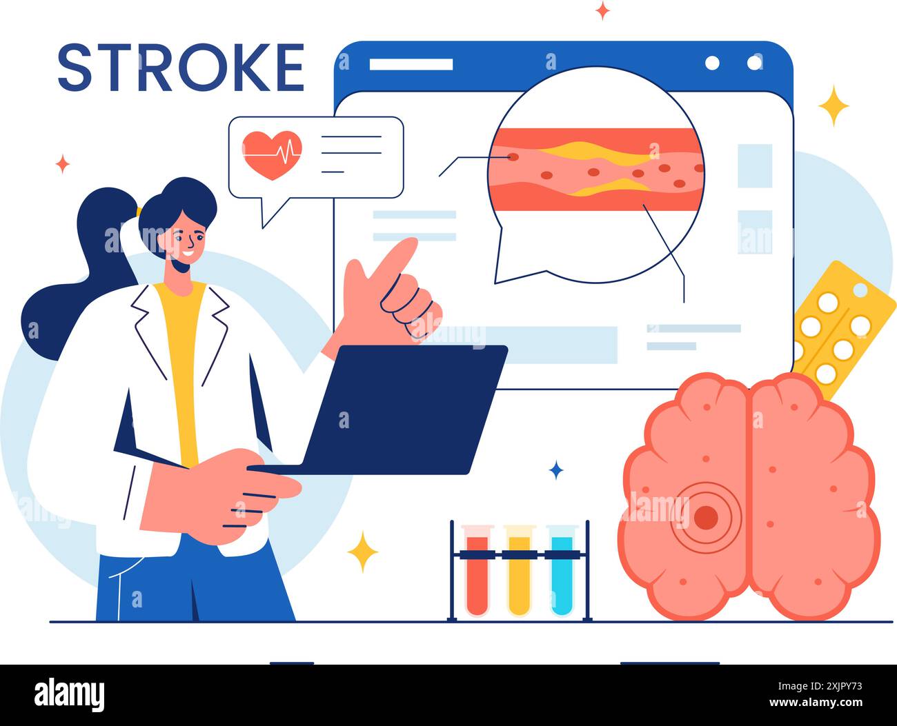 A Vector Illustration of Human Brain Stroke Highlighting Medical ...