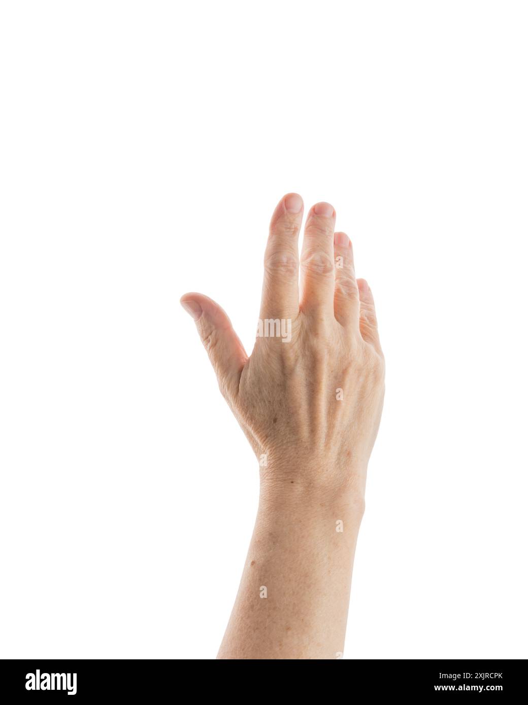 Nevus hand hi-res stock photography and images - Alamy
