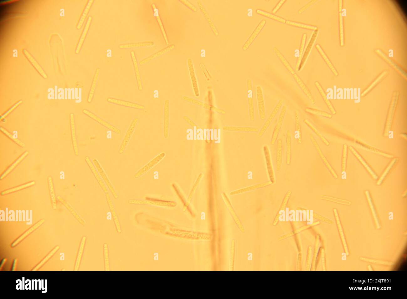 Drumstick Truffleclub (Tolypocladium capitatum) Fungi Stock Photo - Alamy