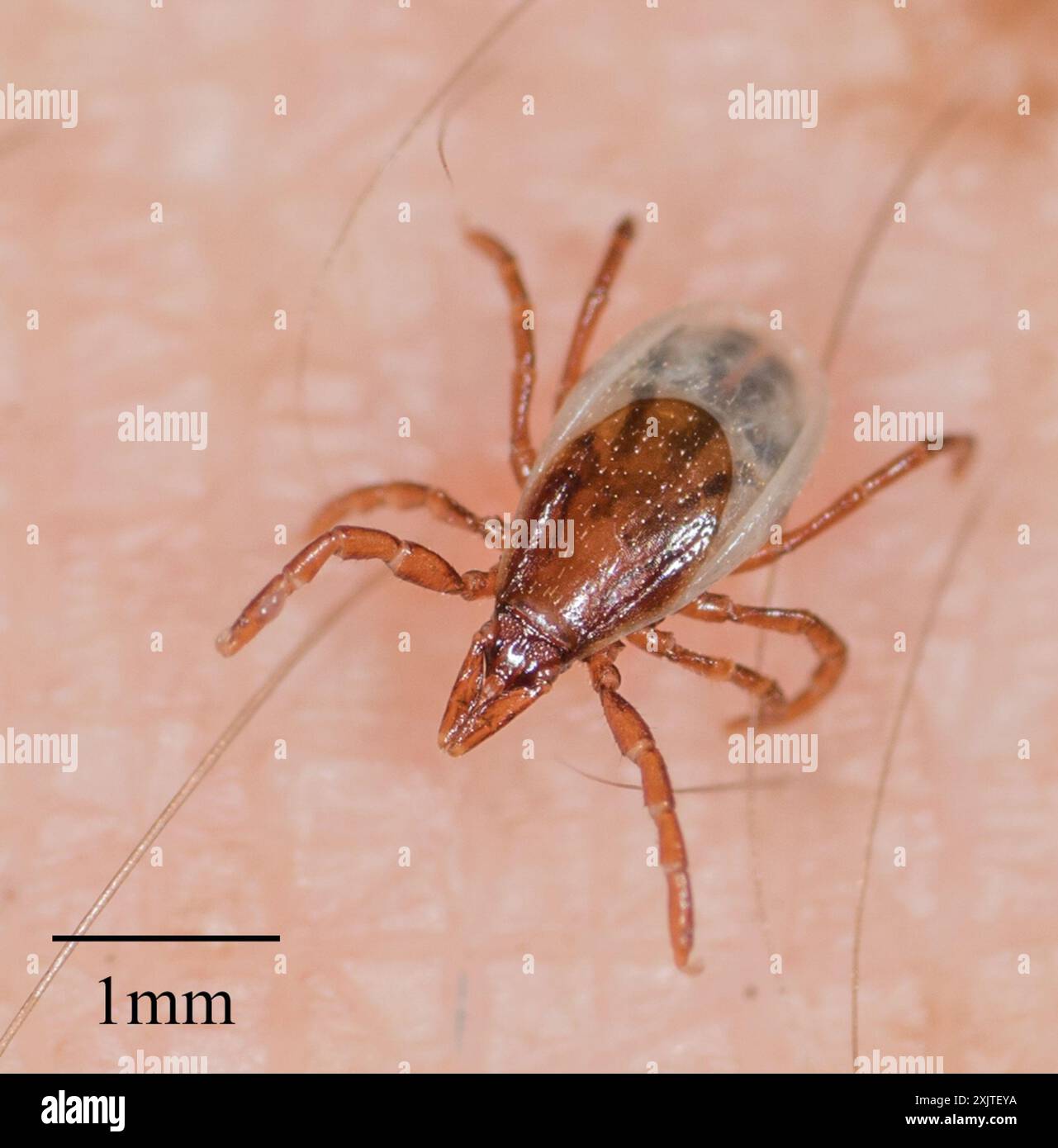 Mites and Ticks (Acari) Arachnida Stock Photo - Alamy