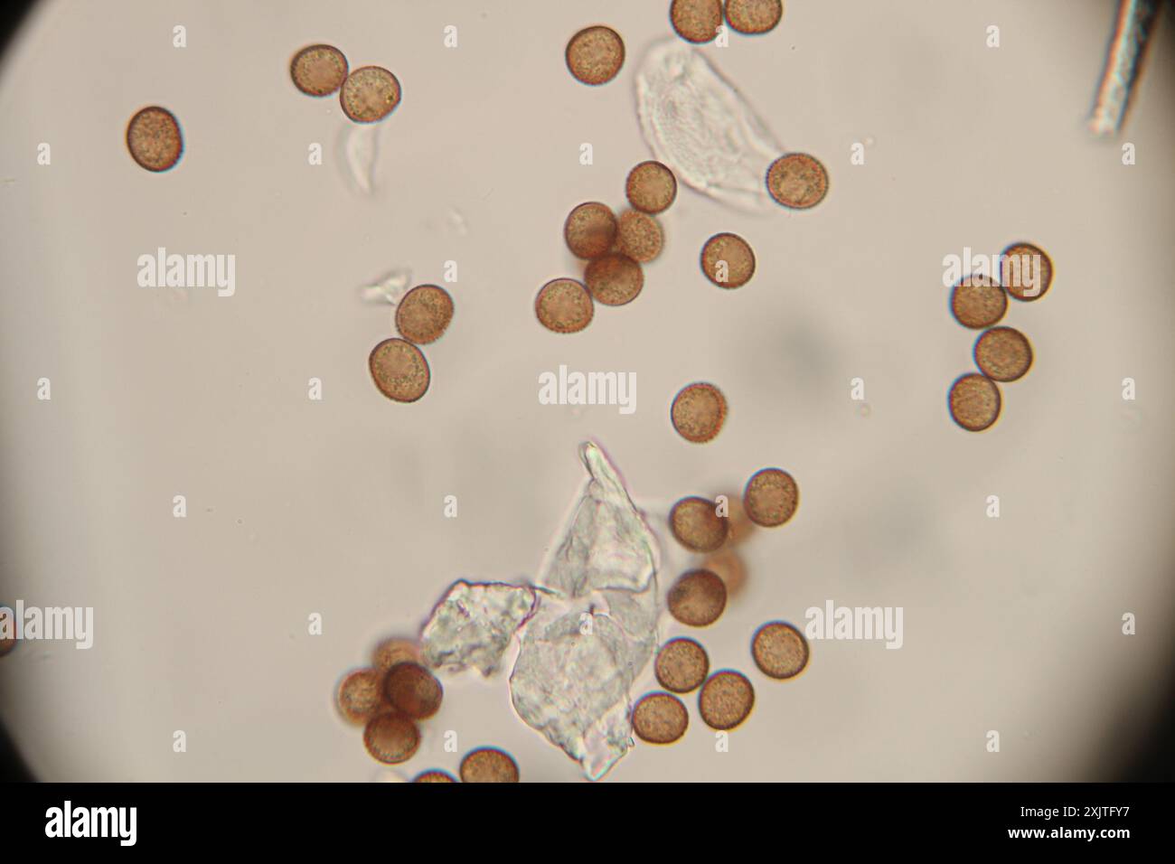 (Badhamia utricularis) Protozoa Stock Photo - Alamy