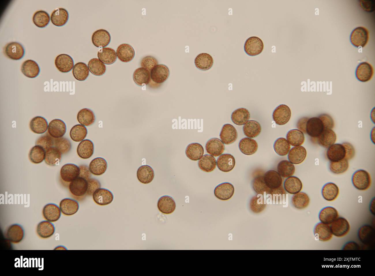 (Badhamia utricularis) Protozoa Stock Photo - Alamy