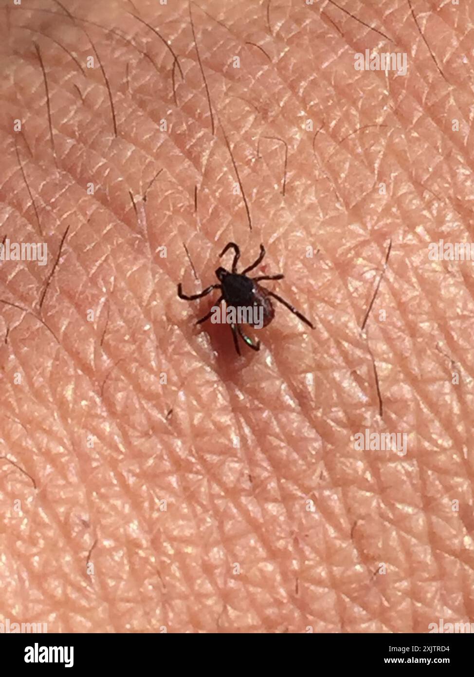 Western Black-legged Tick (Ixodes pacificus) Arachnida Stock Photo - Alamy