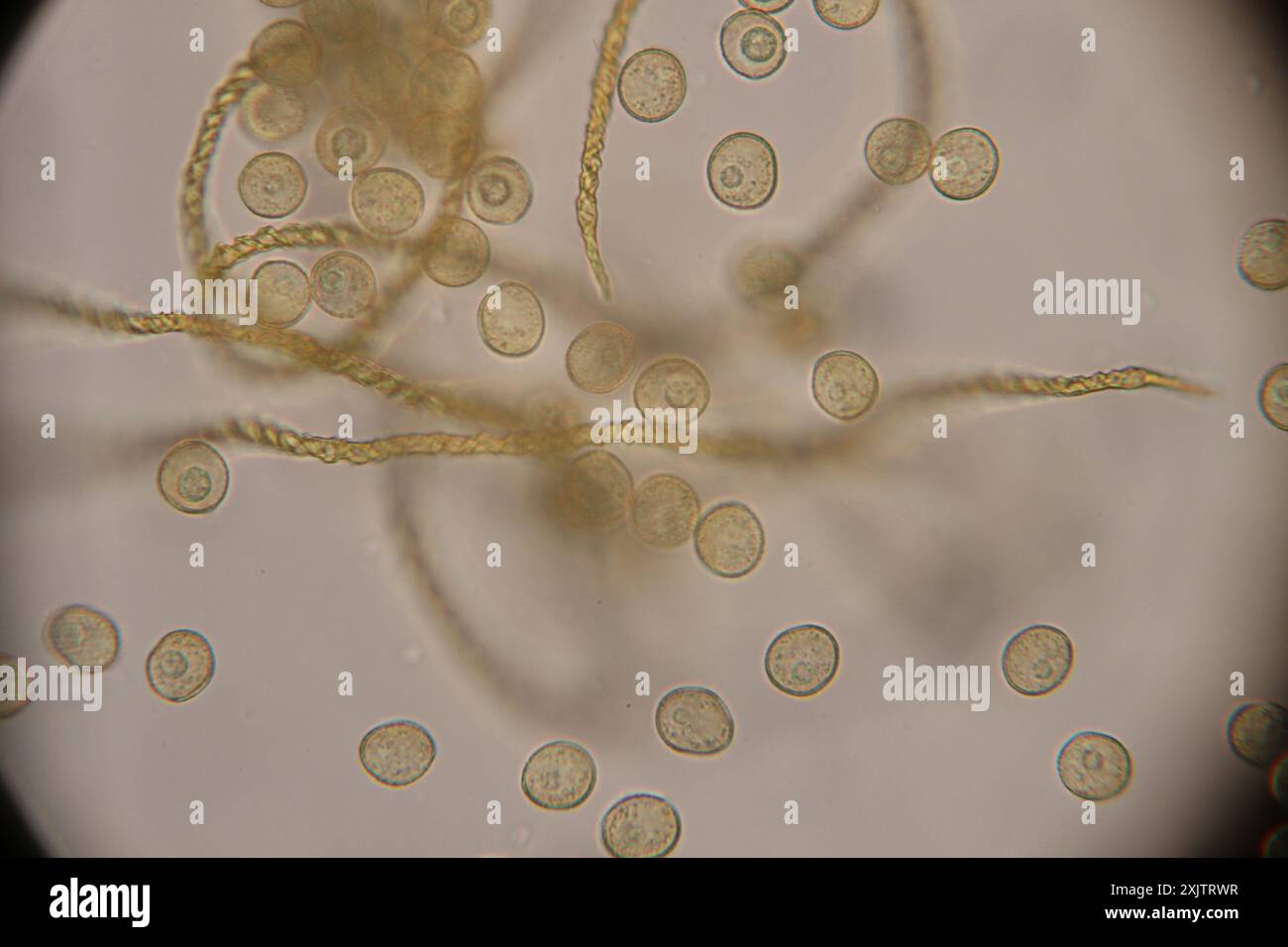 (Trichia varia) Protozoa Stock Photo - Alamy