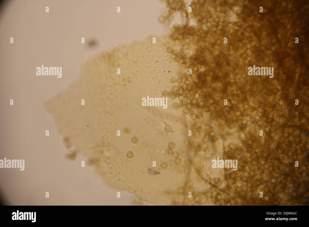 (Trichia varia) Protozoa Stock Photo - Alamy