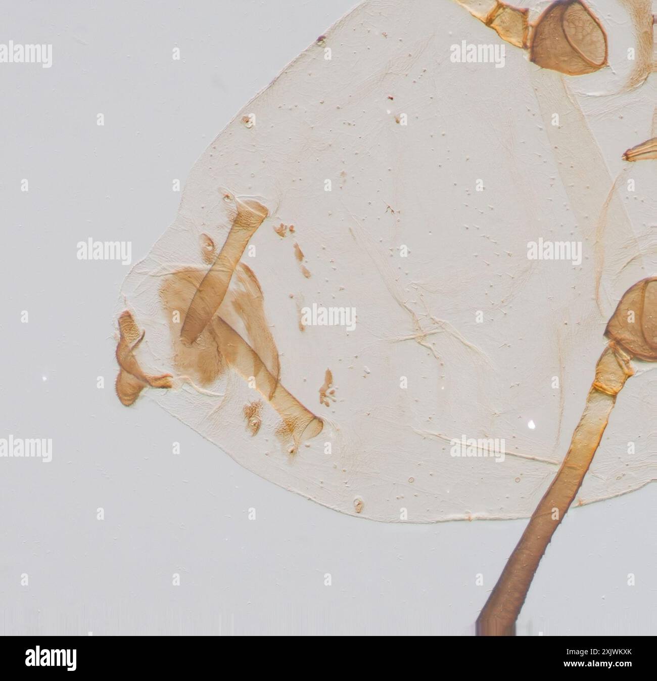 Onion Aphid (Neotoxoptera formosana) Insecta Stock Photo - Alamy