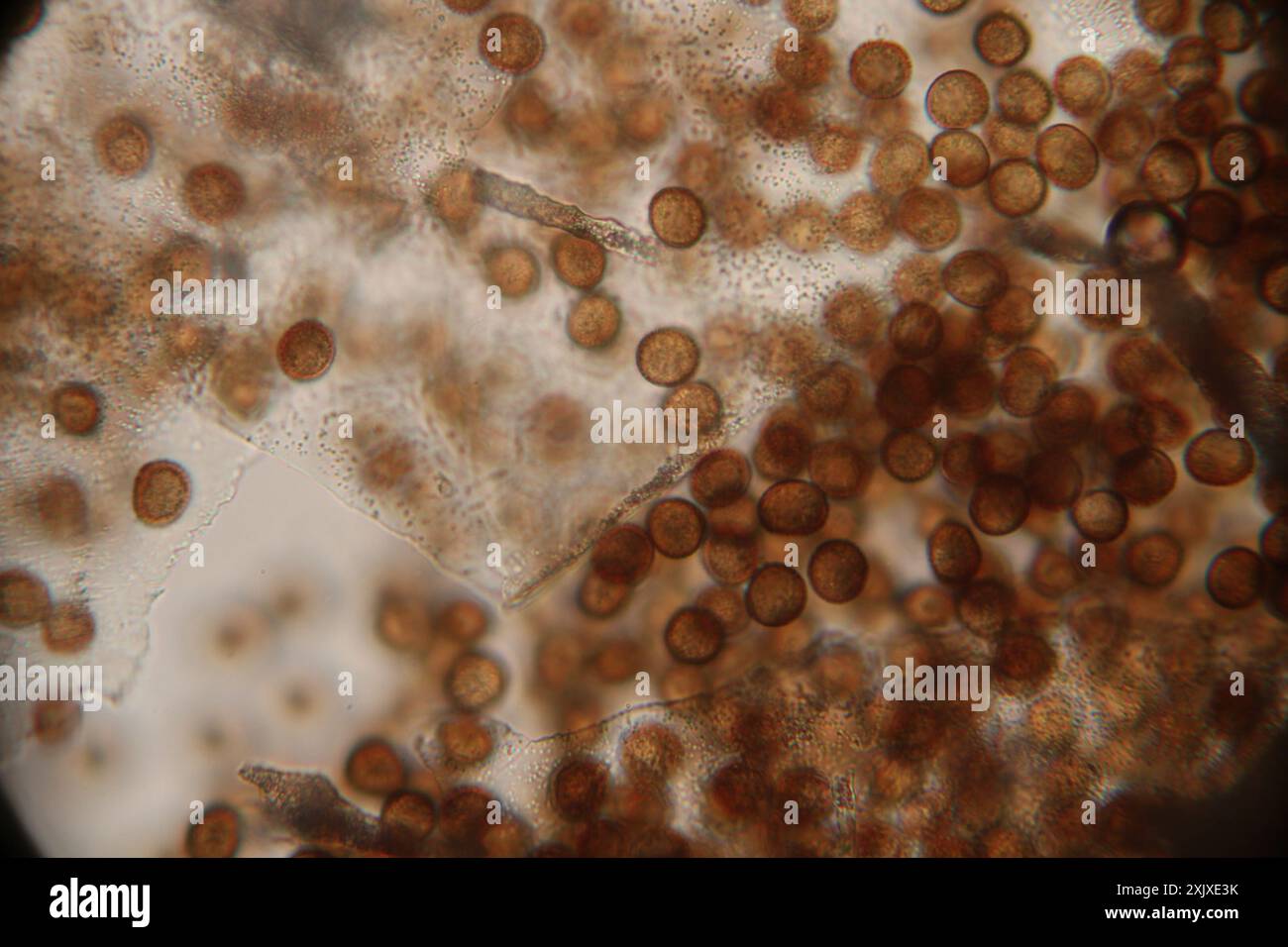 (Badhamia utricularis) Protozoa Stock Photo - Alamy