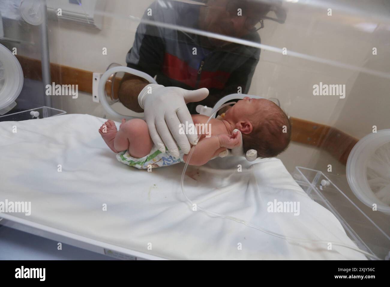 A Palestinian infant Malek Yassin, one day old, is receiving treatment ...