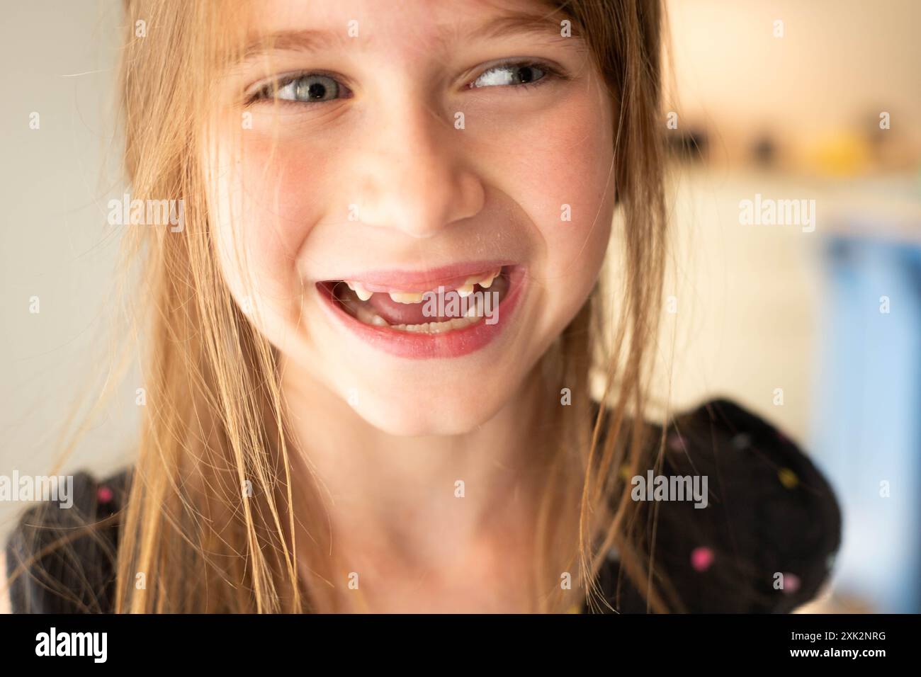 Caucasian blonde child girl, close up portrait, smiling with missing teeth. Sweet, funny ...